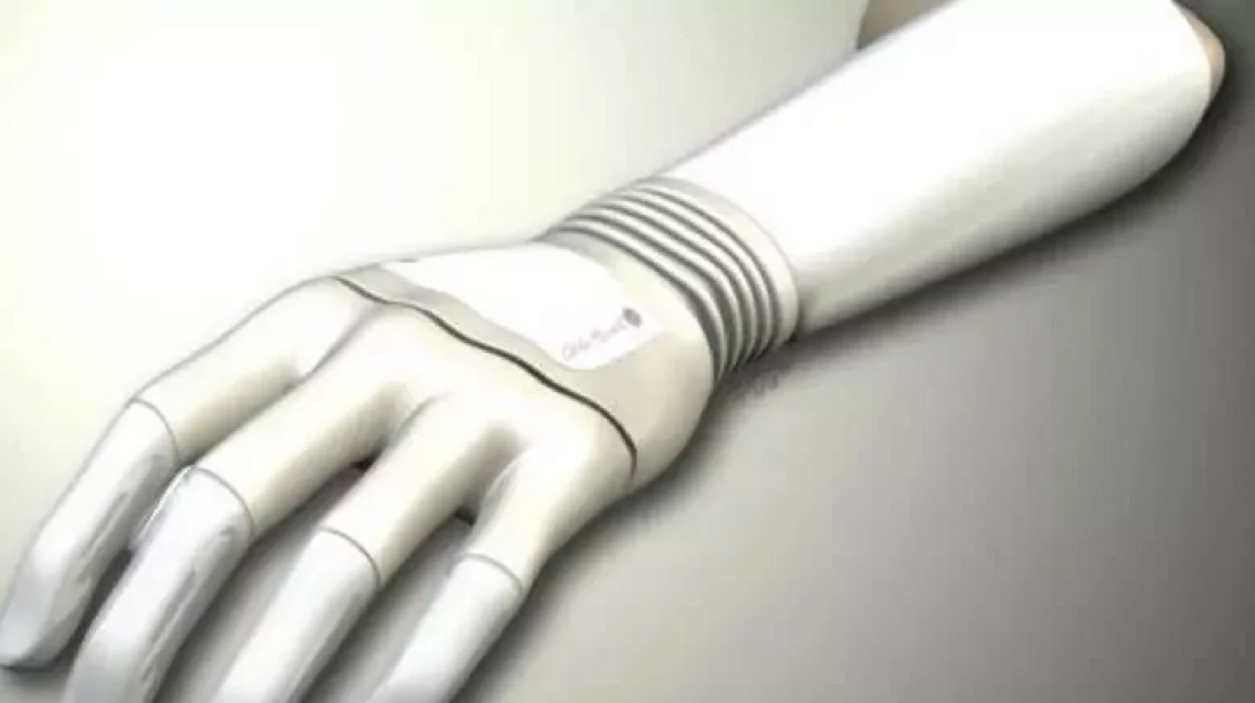 Ground breaking bionic hand fitted in the UK | Healthcare Digital