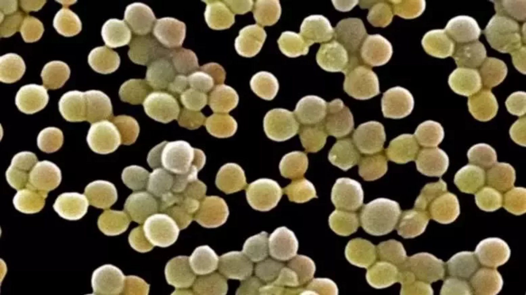 New MRSA superbug strain found in British cow milk | Healthcare Digital