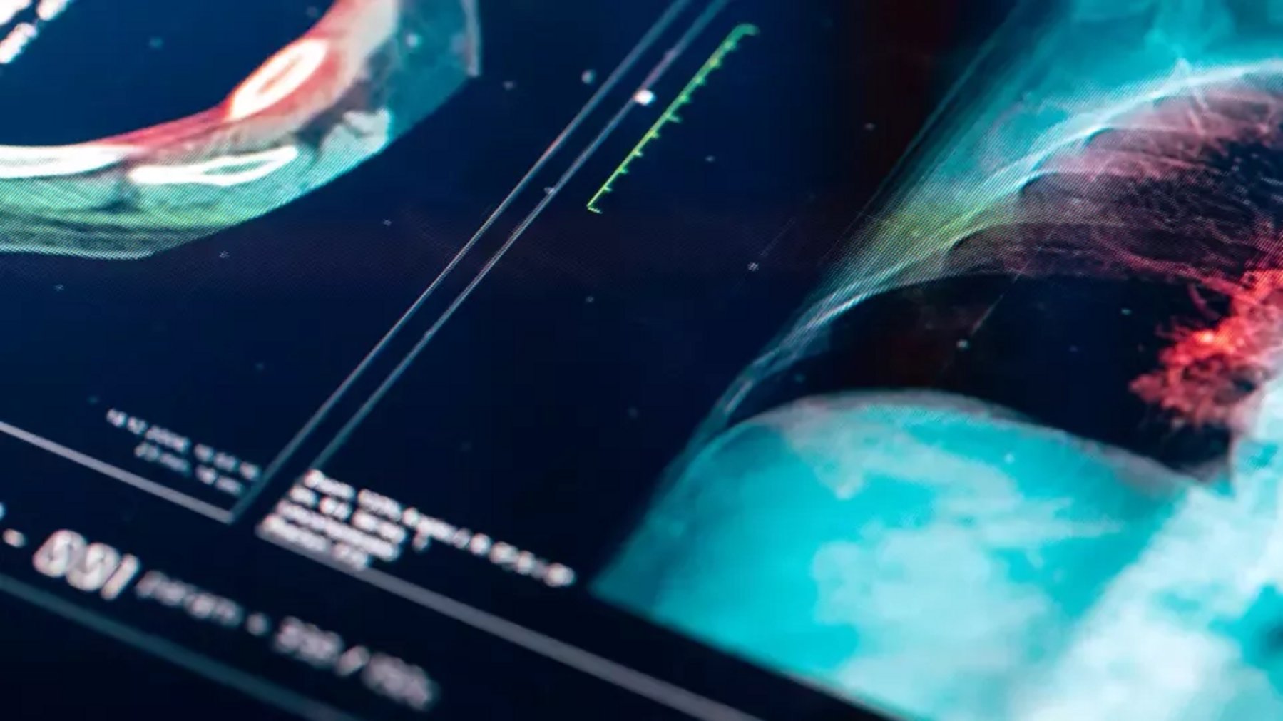 Optellum’s new collaboration for AI lung cancer diagnosis | AI Magazine