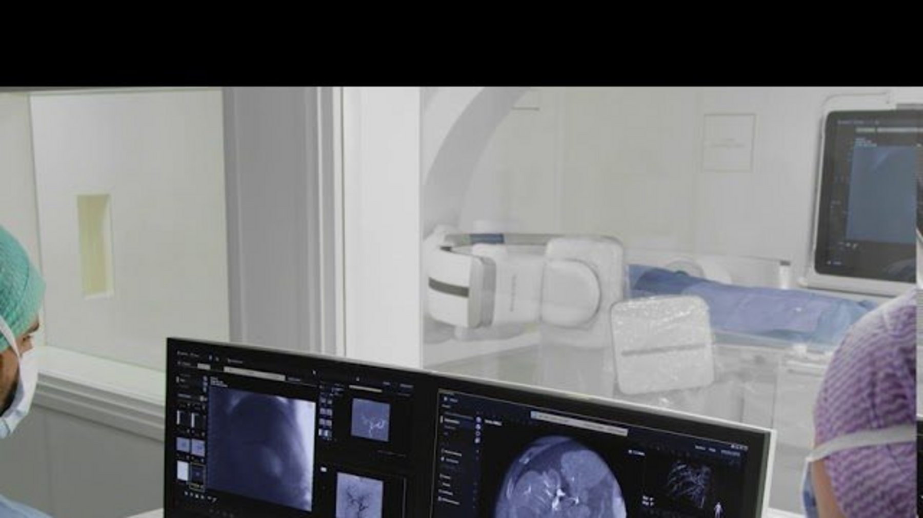 Simplifying and advancing 3D imaging with SmartCT in trans arterial ...