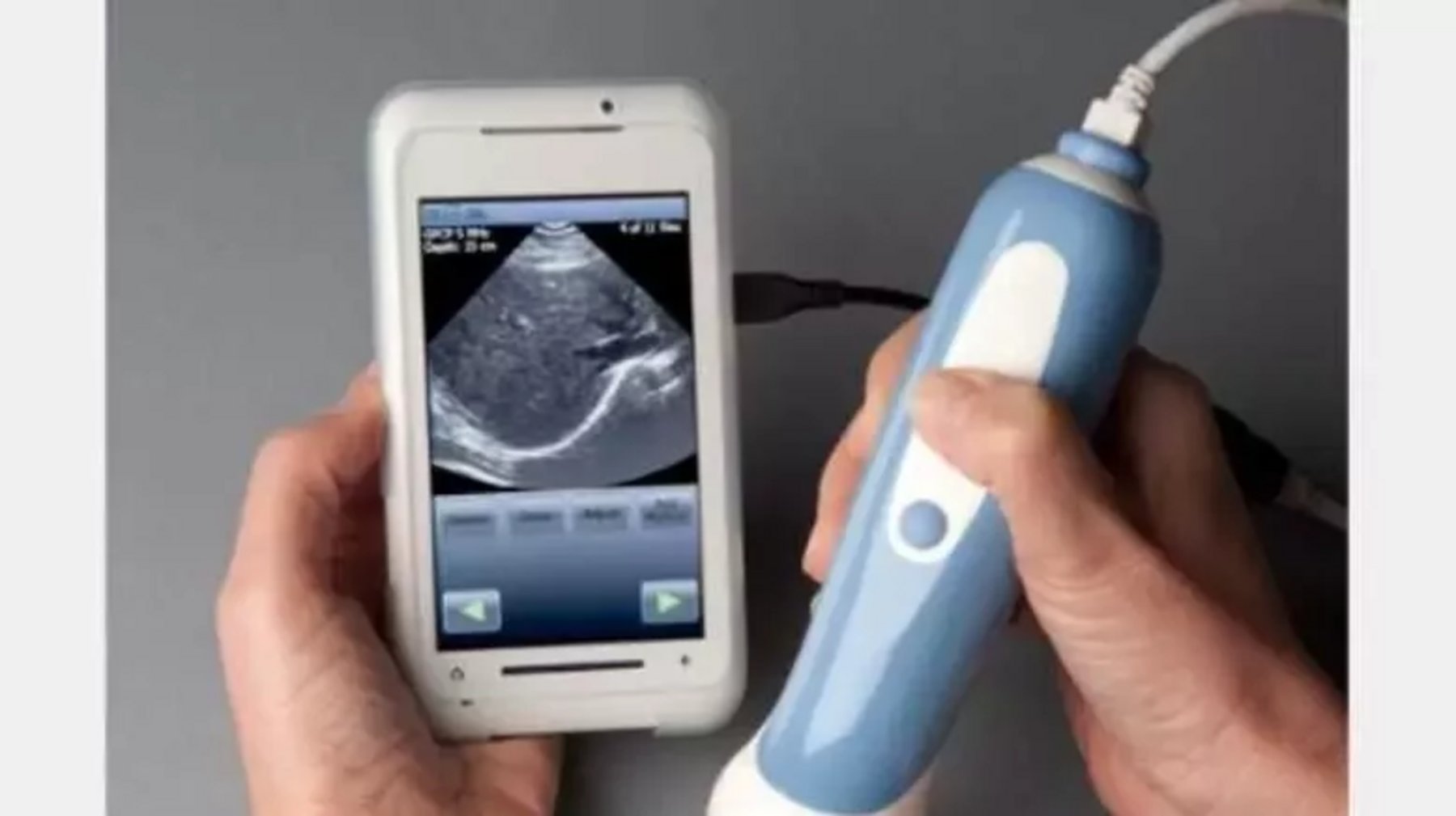Ultrasound device for smartphones launched | Healthcare Digital