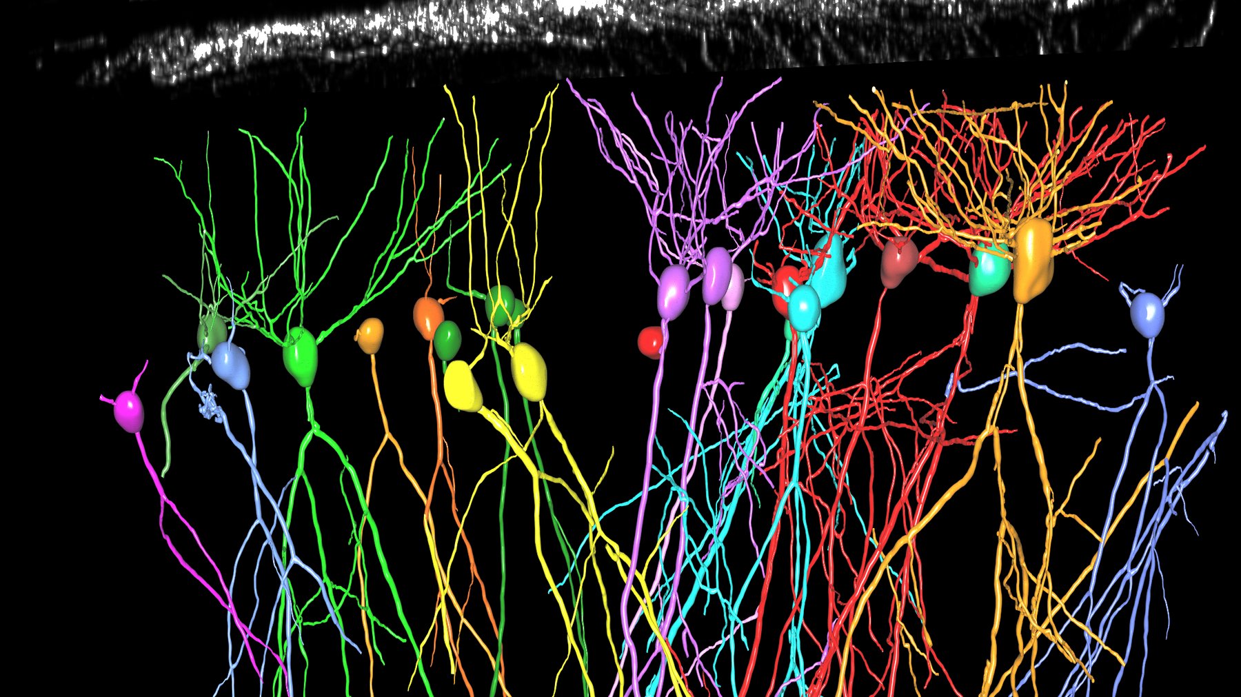 Microscopy and AI: maximising its potential for the future | AI Magazine