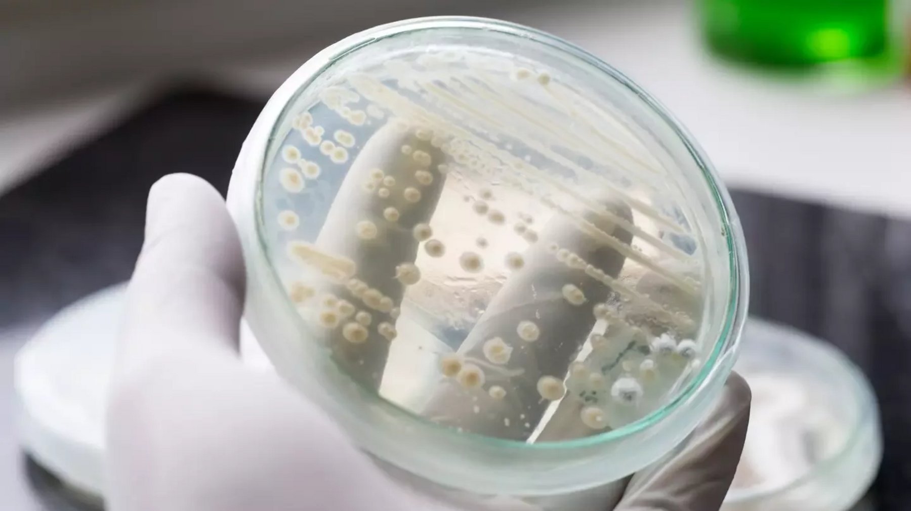 The new superbug Candida auris and how to stop its spread | Healthcare ...