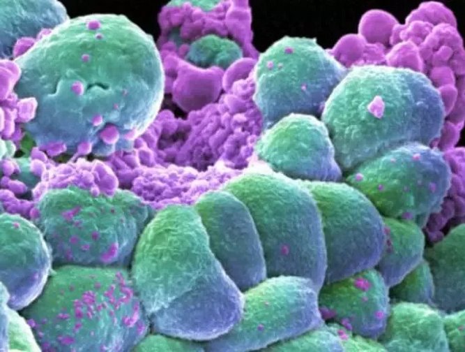 Roche Breast Cancer Drug Receives FDA Approval | Healthcare Digital