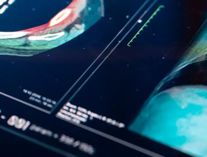 Optellum’s new collaboration for AI lung cancer diagnosis | AI Magazine