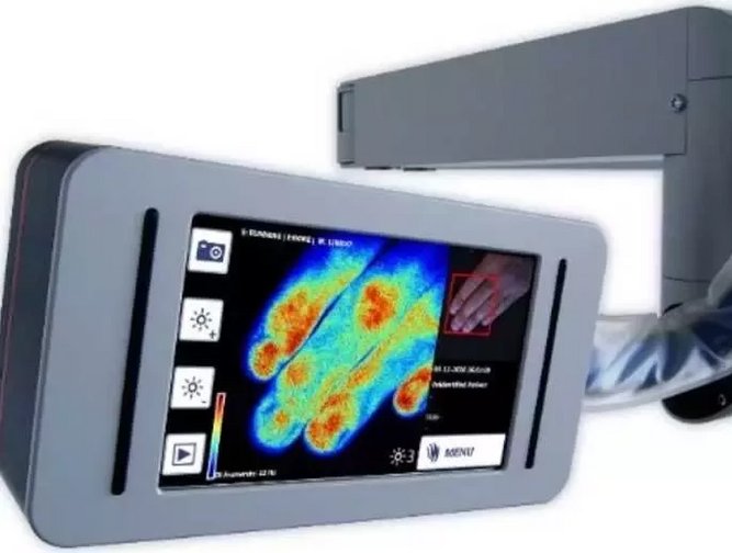 Camera shows blood flow in skin to help burns victims | Healthcare Digital