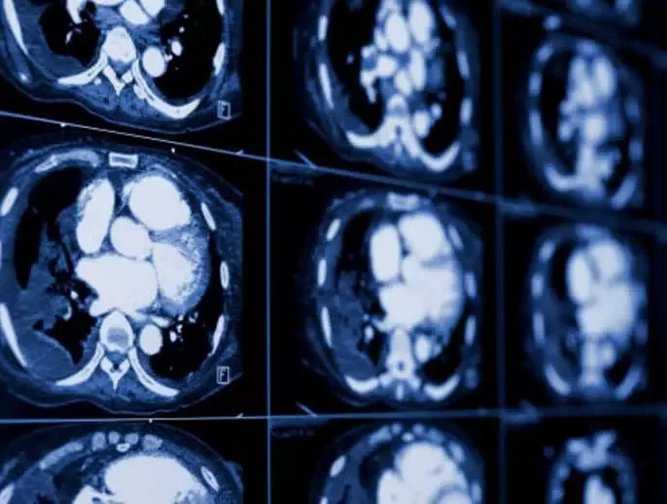 Touch Medical Imaging Software Receives US FDA Approval | Healthcare ...