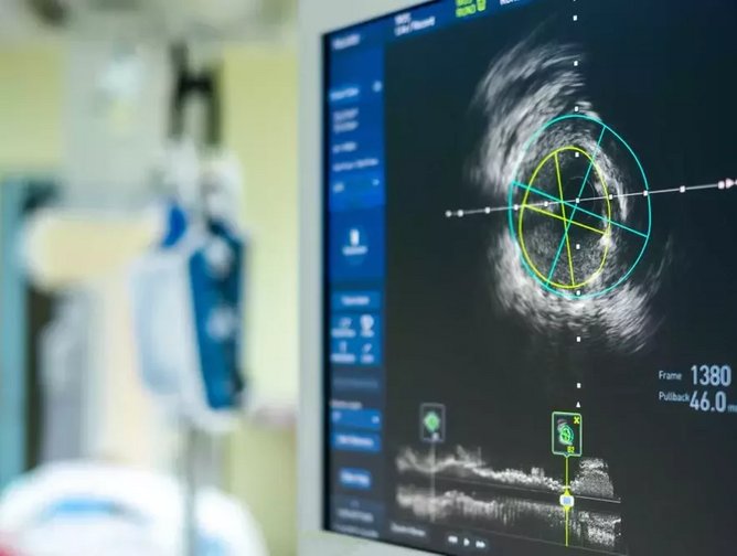 Intelerad acquires LUMEDX, expands cardiovascular expertise ...