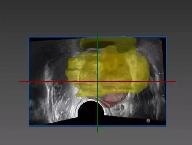 RSIP Vision launches AI-based MRI and ultrasound tool | Healthcare Digital RSIP Vision launches AI-based MRI and ultrasound tool | Healthcare Digital