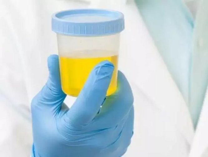 Why random drug testing in the workplace is a good idea | Healthcare ...