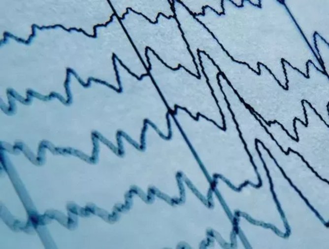 Startup Spotlight: Kernel’s non-invasive brain recording | Healthcare ...