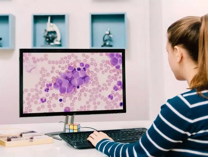 AI-powered blood analysis to "improve outcome of diagnosis ...