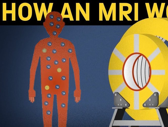 How does an MRI machine work? | Healthcare Digital