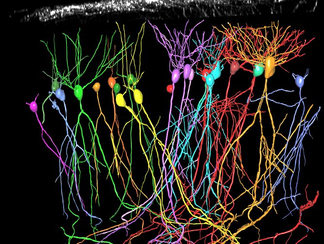 Microscopy and AI: maximising its potential for the future | AI Magazine
